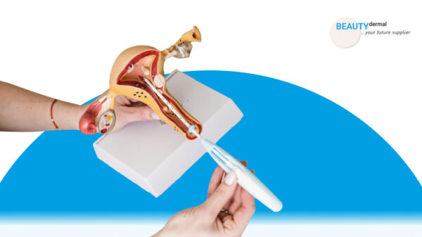 IUD And Acne: Causes And Prevention - Beauty Dermal