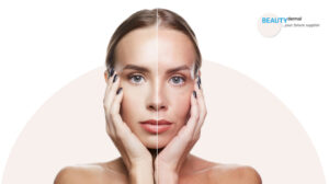 Full Face Botox: Before- and After-Treatment Considerations and ...